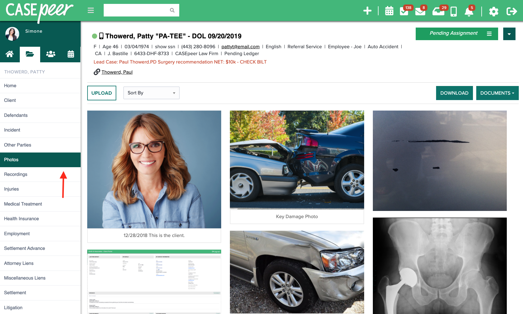 Delete a Photo – CASEpeer